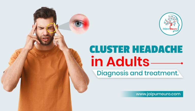 Cluster Headache in Adults: Diagnosis and treatment - Dr. VIkram Bohra